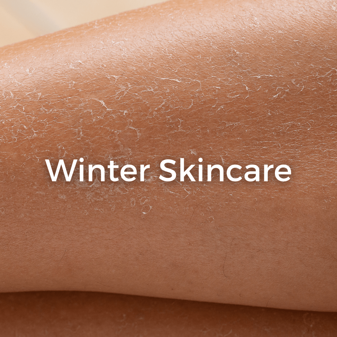 8 Winter Skincare Musts to Avoid Dry, Flaky Skin! – CHEEKYGLO